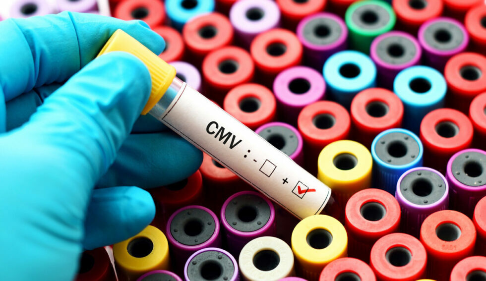 What is CMV? - Seattle Sperm Bank