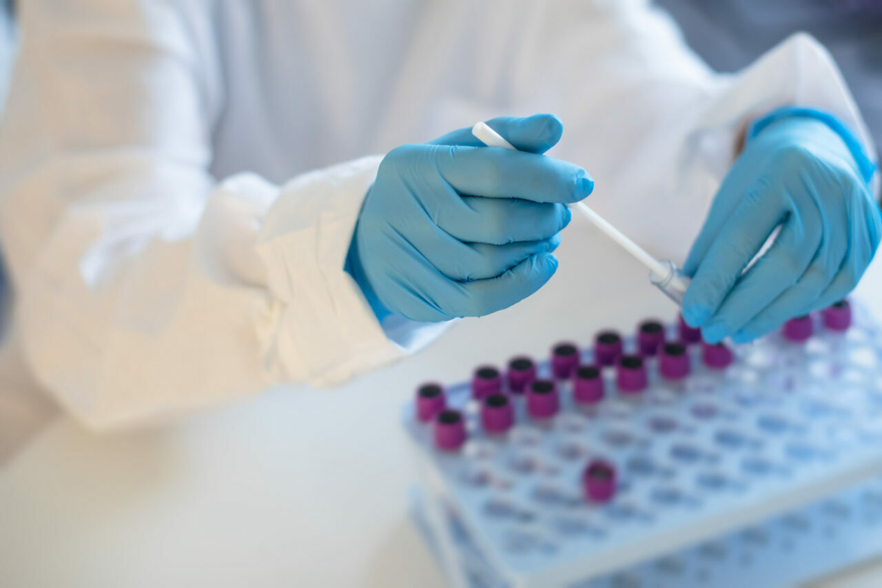 Donor Testing and Screening - Seattle Sperm Bank